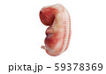 Embryo human fetus unborn, side view - Stock Illustration [59378372 ...